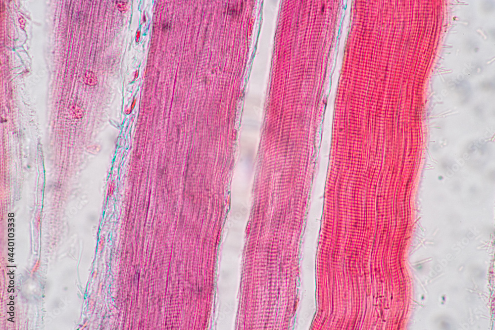Characteristics of anatomy and Histological sample Striated (Skeletal ...