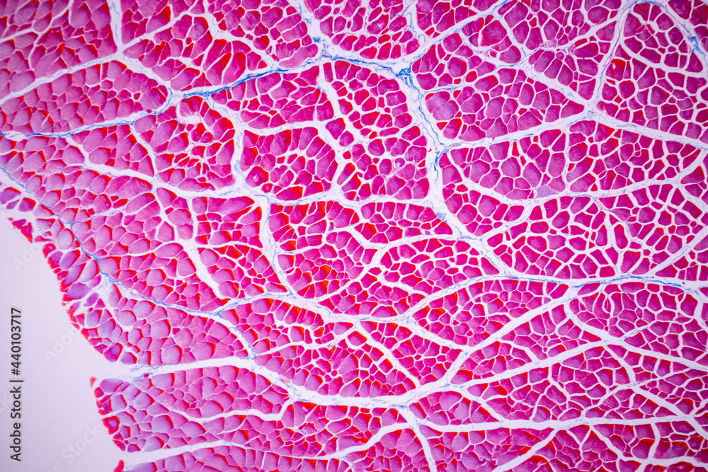 Characteristics of anatomy and Histological sample Striated (Skeletal ...