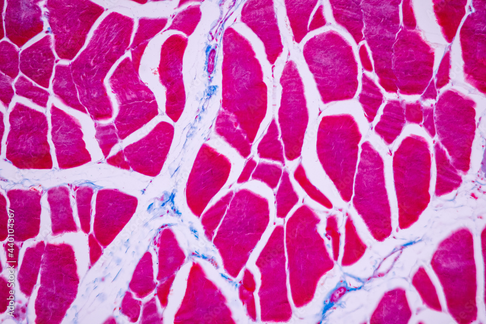 Characteristics of anatomy and Histological sample Striated (Skeletal ...