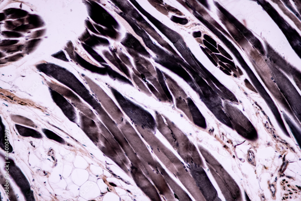 Characteristics of anatomy and Histological sample Striated (Skeletal ...