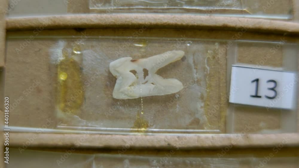 Stained histology slide which is ready for microscopic examination ...