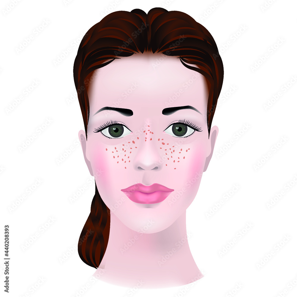 Beautiful girl with freckles on her face. Template for cosmetology ...