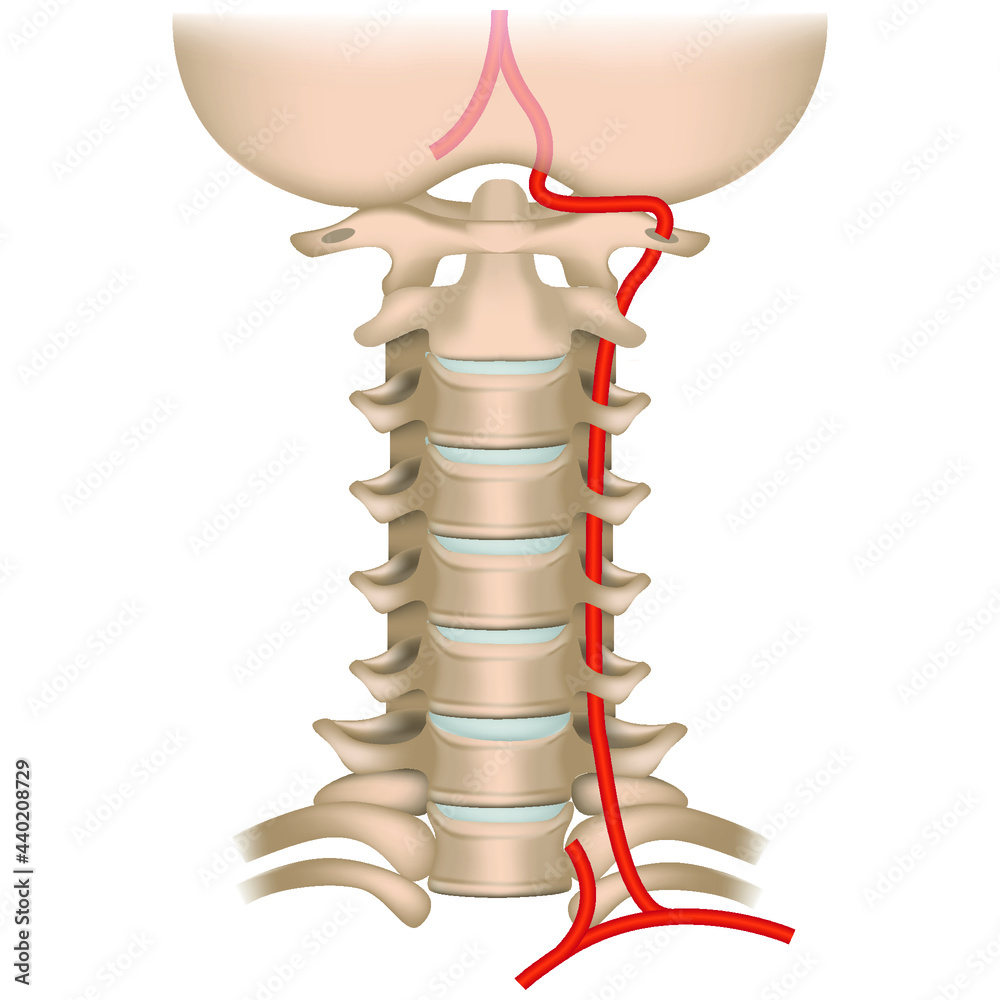 vertebral artery syndrome. Cervical spine. Vertebro basilar pool. Veins ...