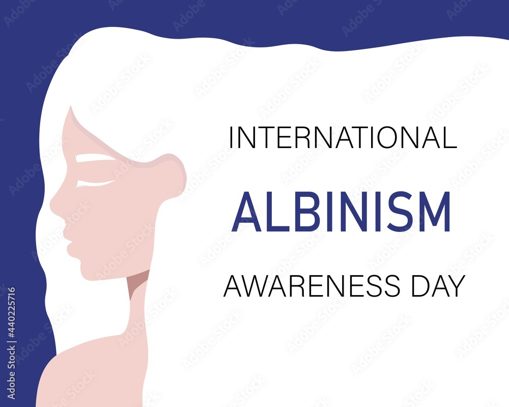 International albinism awareness day, 13 June. Illustration of albino ...