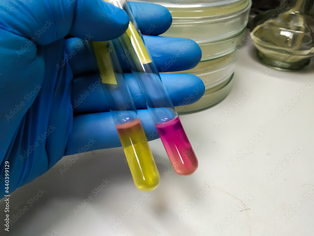 MIU Medium Base (Motility Indole Urea Medium) at microbiologist hand at ...