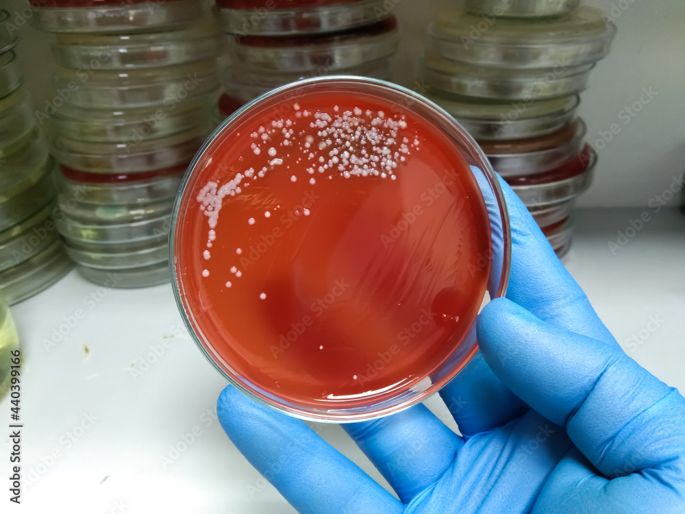 Bacterial culture on petri dish, urinary tract infection Streptococcus ...