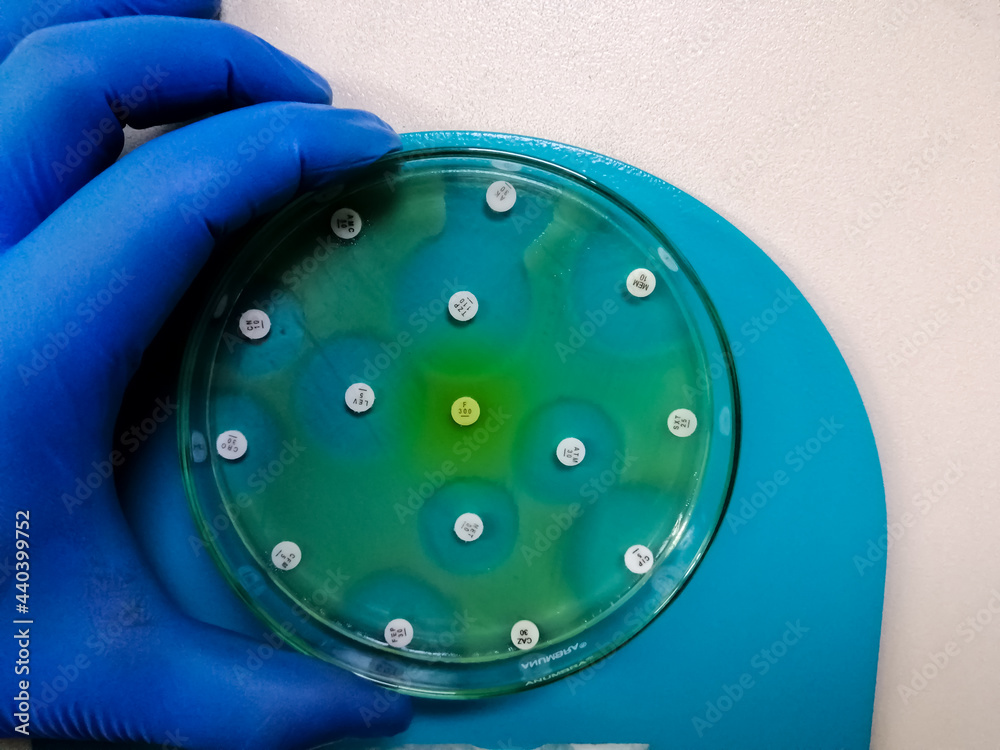 Antimicrobial susceptibility testing in petri dish against pseudomonas ...