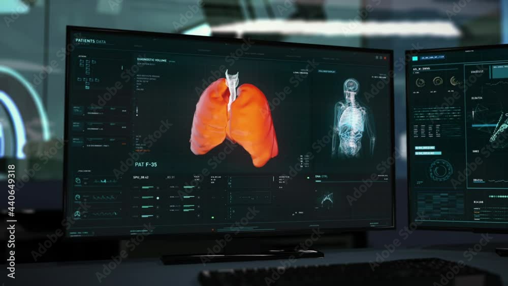 Visualization Of Lungs In Modern medical Scientific Software On ...