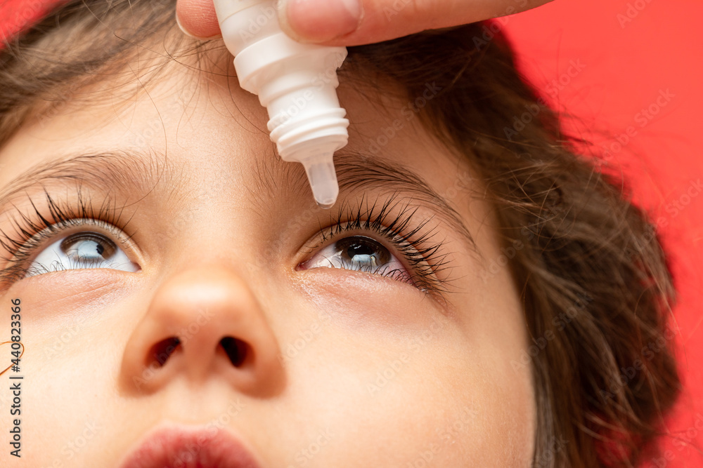 treatment, using therapeutic, medical eye drops for a child with ...