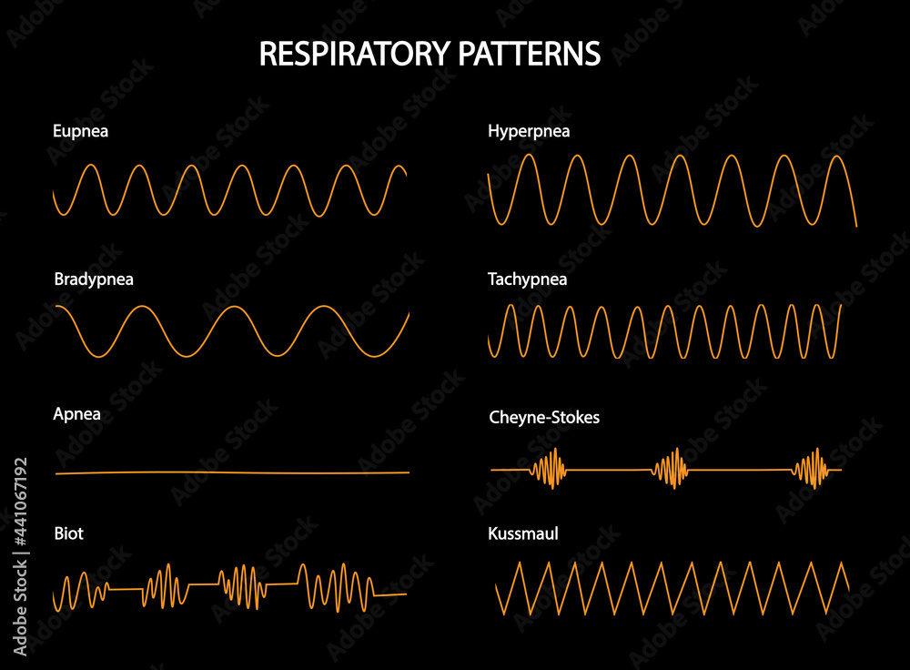 Respiratoy Patterns. Respiratory curves of different situations. Eupnea ...