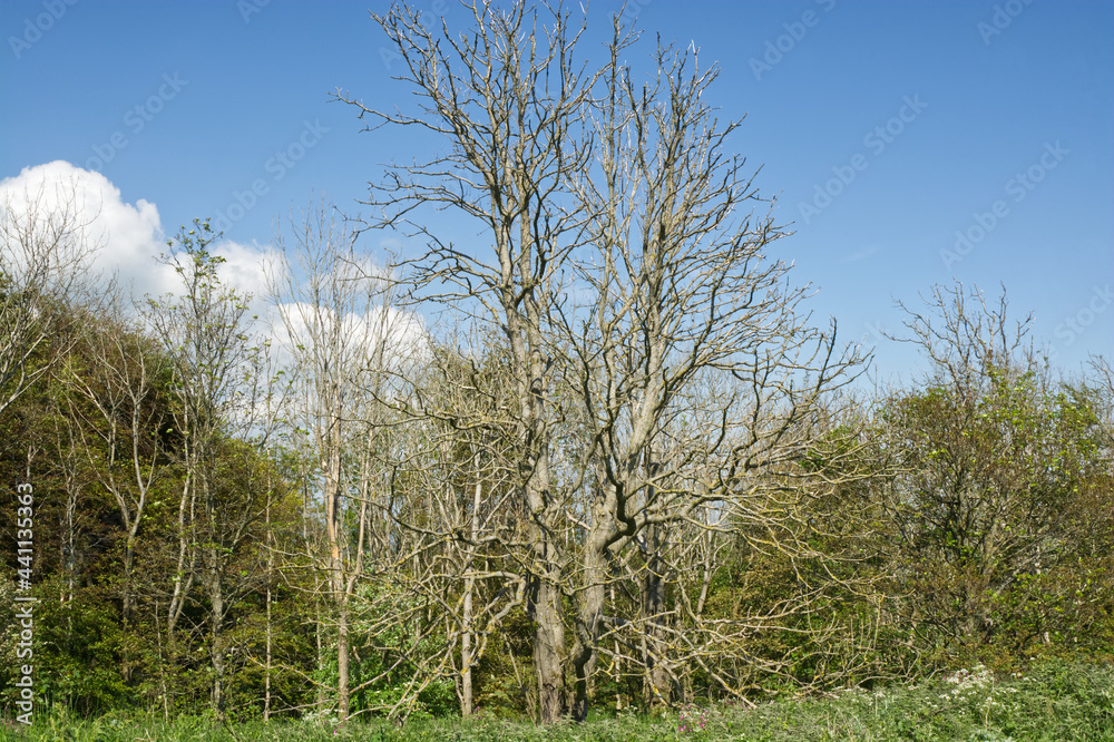 Dead Ash trees on South Downs, Sussex, England. Due to Ash Dieback ...