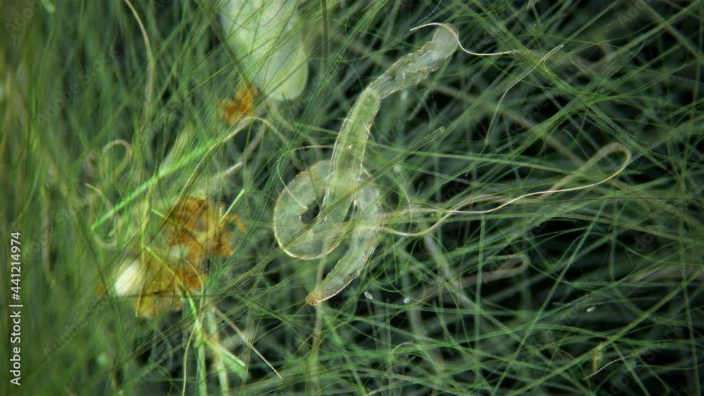 Worm Aeolosoma sp. under a microscope, Aeolosomatidae family. They live ...