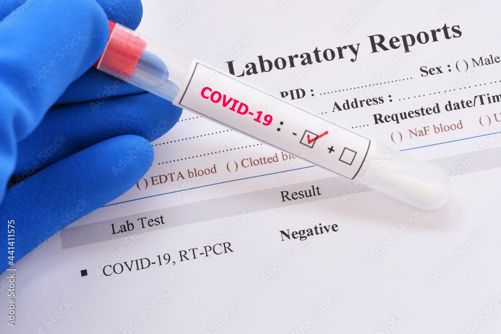 Nasopharyngeal swab negative with COVID-19 test by using RT-PCR method ...