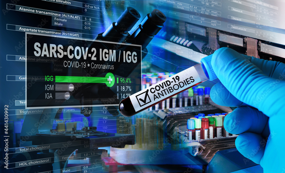 Doctor with a tube of blood of a patient labeled with Covid-19 ...