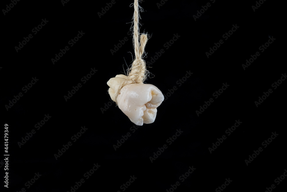 Tooth extracting method. Real human wisdom tooth hanging on thread ...
