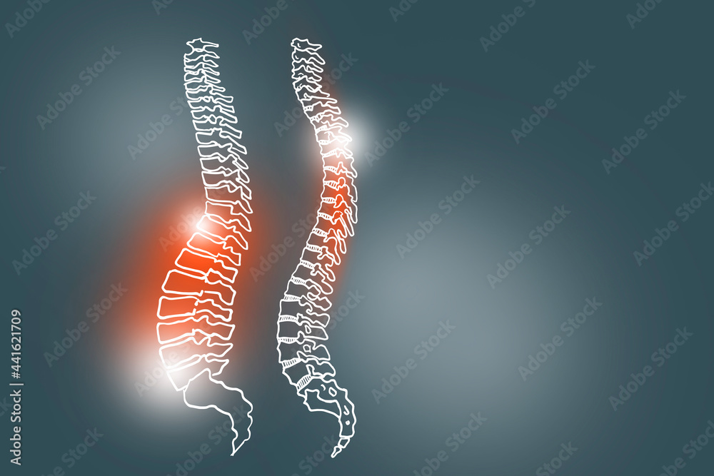 Handrawn illustration of human Spine on dark grey background. Medical ...