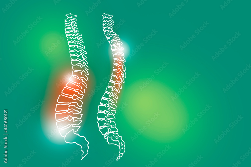 Handrawn illustration of human Spine on light green background. Medical ...