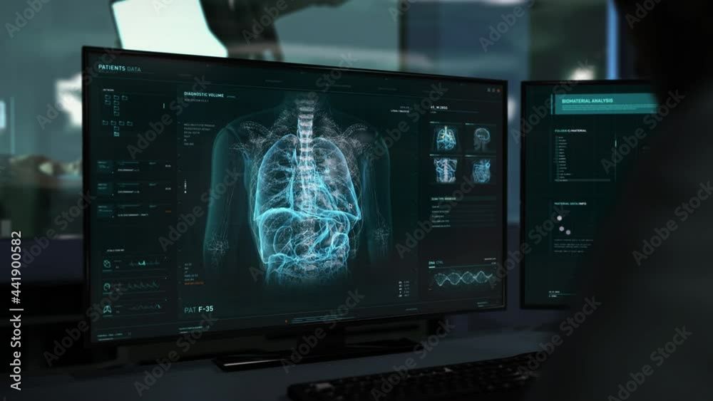 Biological Research Of Lungs In Modern Medical Software Displayed On ...