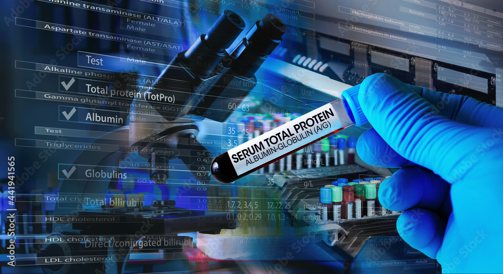 Doctor with blood tube for Proteins test and hematology analyzer ...