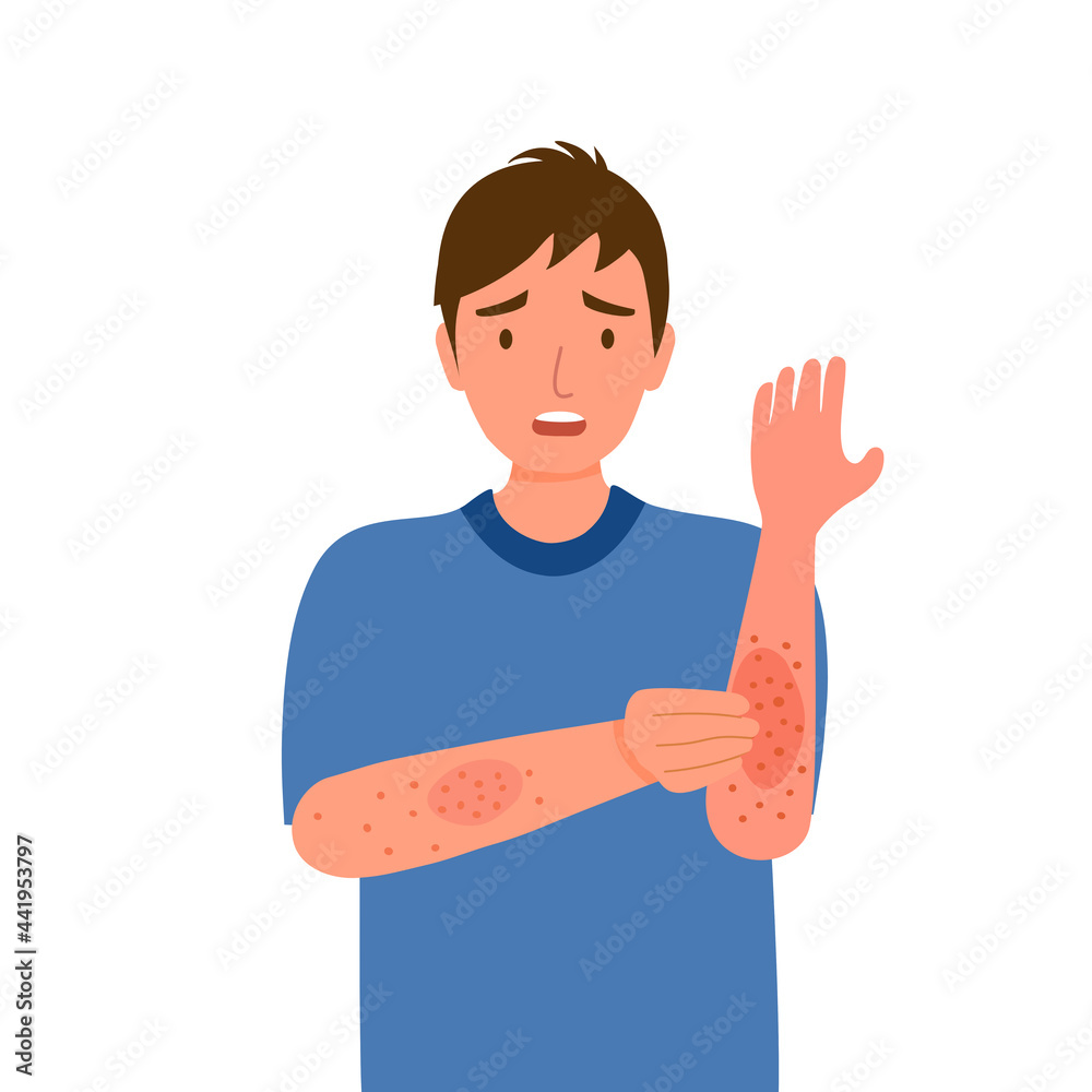 Young man scratching arm. Guy suffering from strong allergy skin itchy ...
