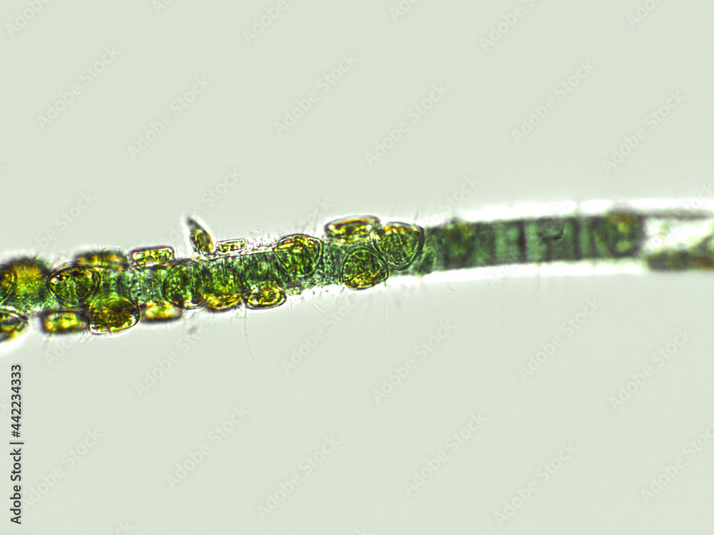 Filamentous Algae Microscope