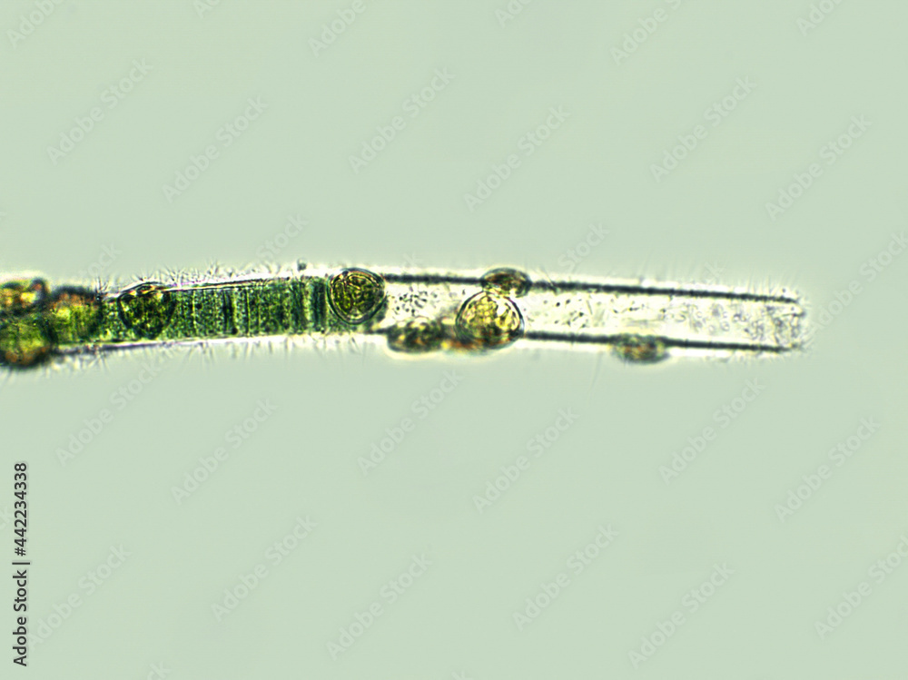 Blue green filamentous algae under microscopic view, cyanobacteria ...