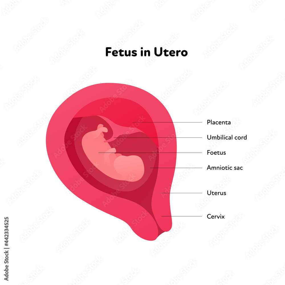 Fetus in utero gynecology infographic diagram. Vector flat healthcare ...