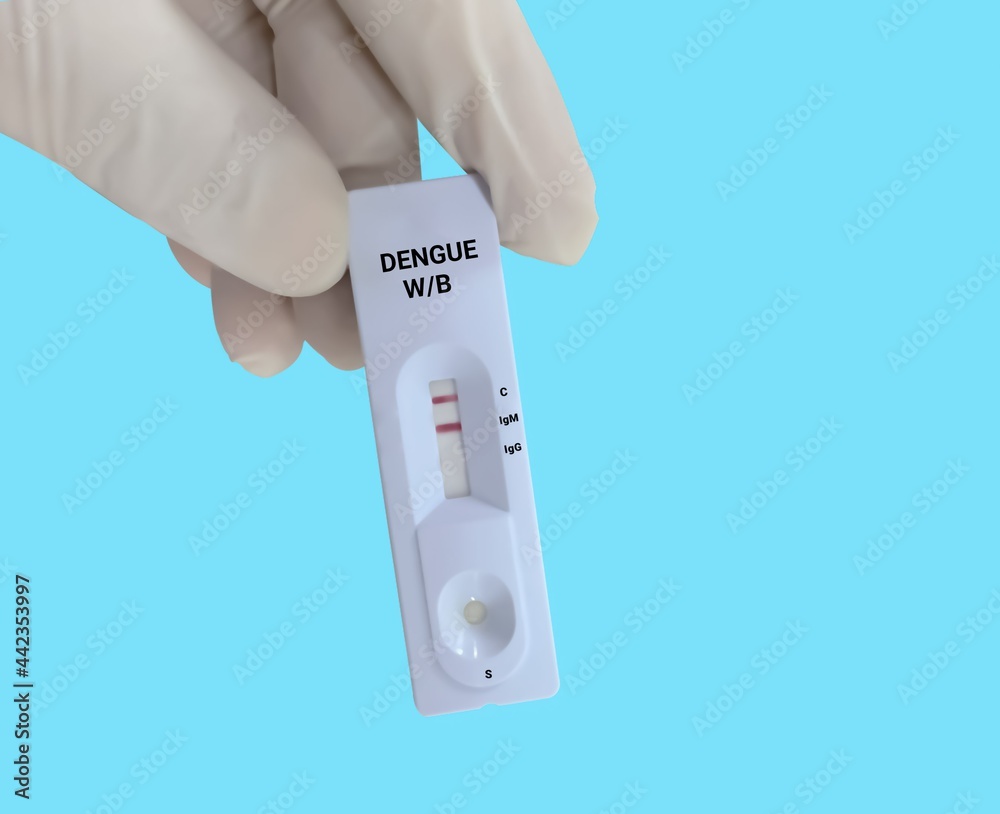 Scientists or Lab Technologists hold a device of Dengue IgG, IgM rapid ...