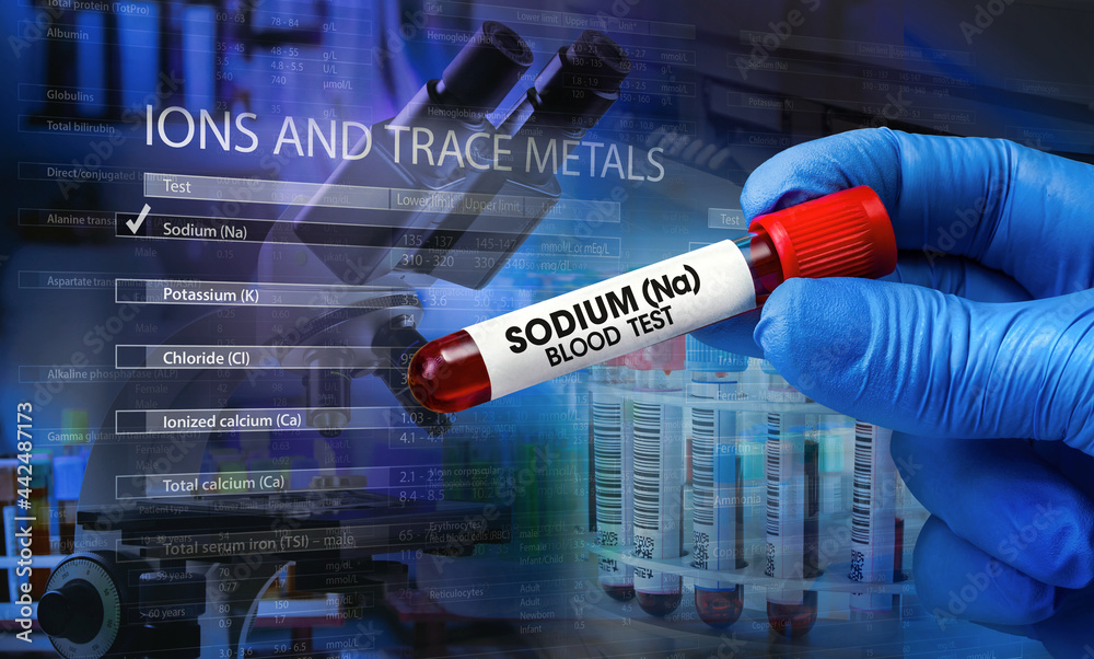 Foto de biochemist with blood tube and hematology analyzer equipment ...