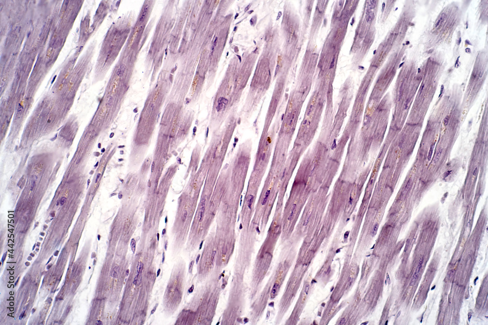 Histology of human cardiac muscle under light microscope view for ...