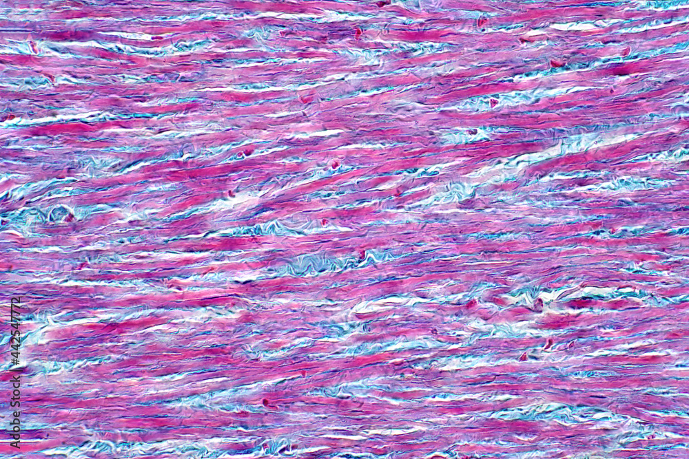 Cross section human tendon under light microscope view for education ...