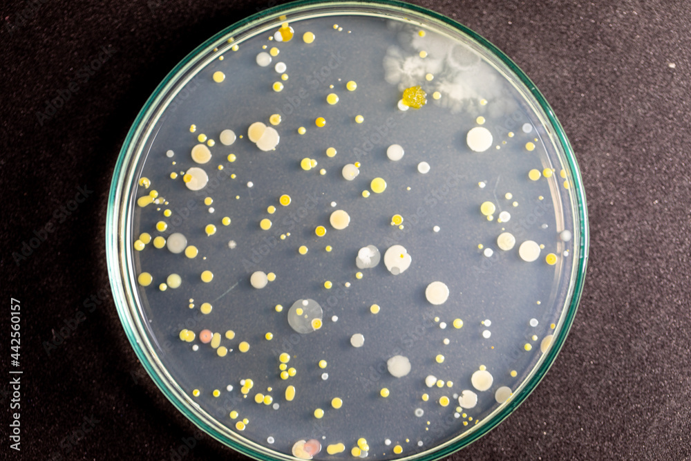 Backgrounds of Characteristics and Different shaped Colony of Bacteria ...
