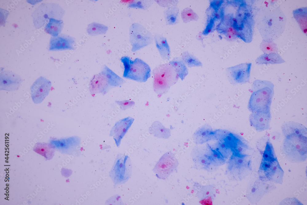 Foto de Characteristics of anatomy and Histological sample Squamous ...