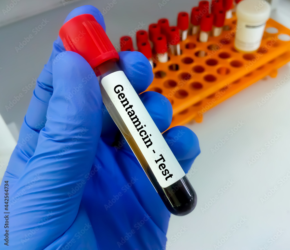 Blood sample for Gentamicin test. monitor the level of gentamicin in ...