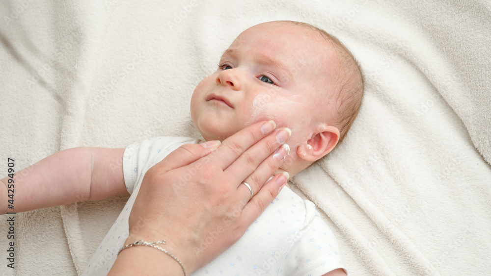Mother using moisturizing creme for curing acne and dermatitis on her ...
