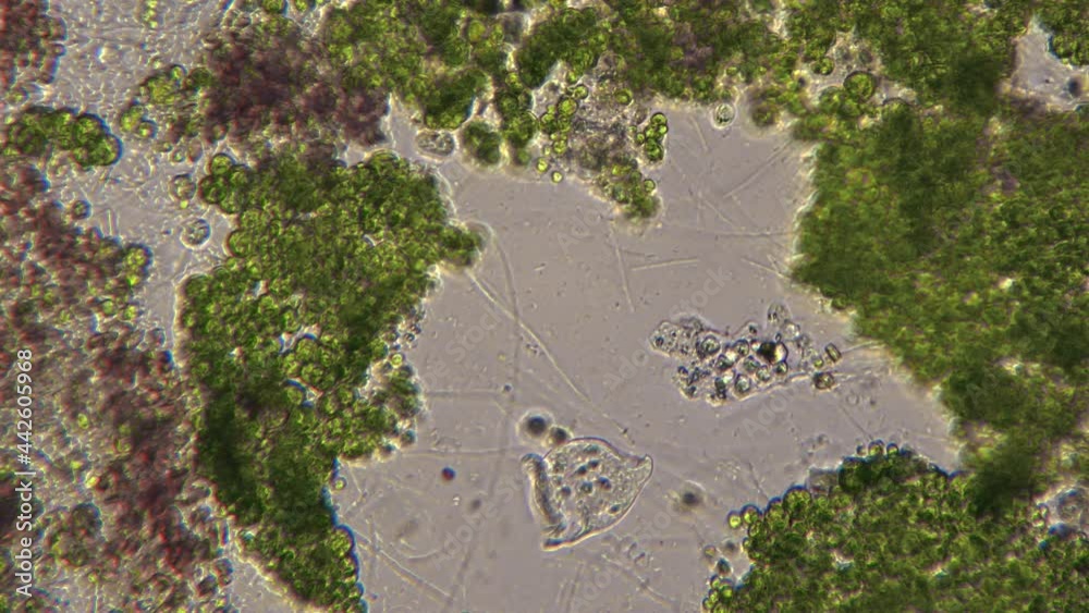Amoeba and Vorticella hunt among unicellular algae. The incredible and ...