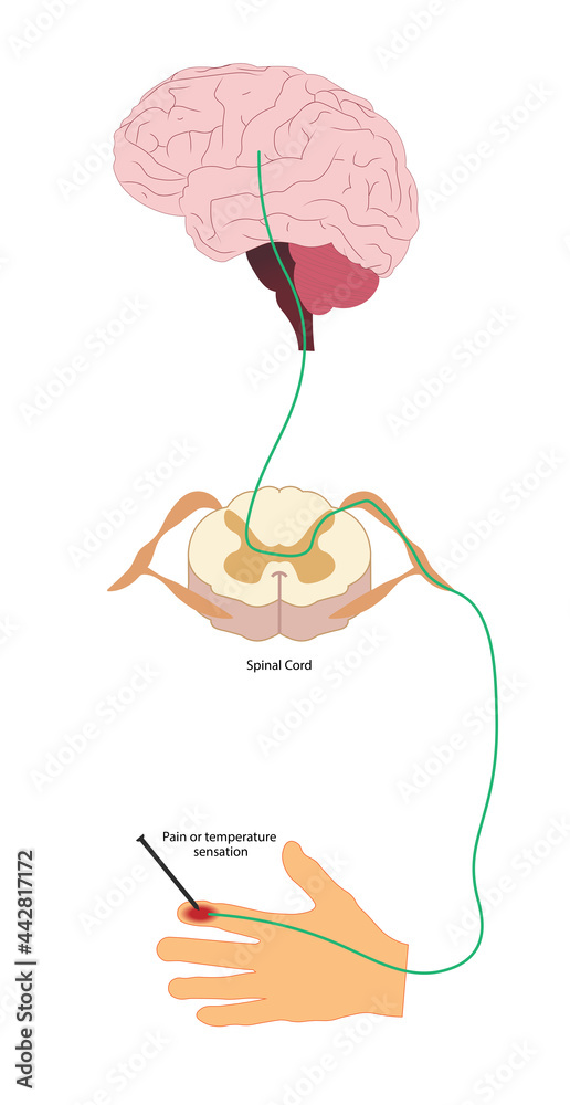 Pain Pathway. Nociception. Ascending pathway that connect the periphery ...