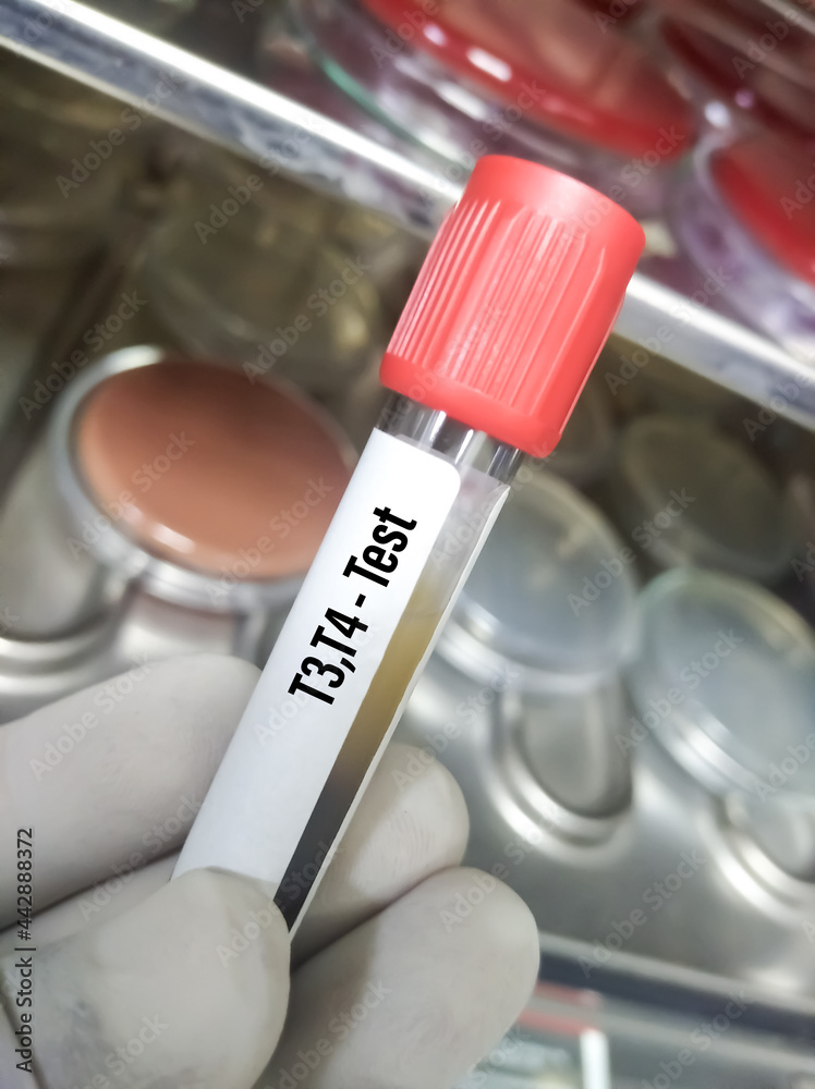 Blood sample tube for Thyroid panel T3,T4 test. Diagnosis of ...