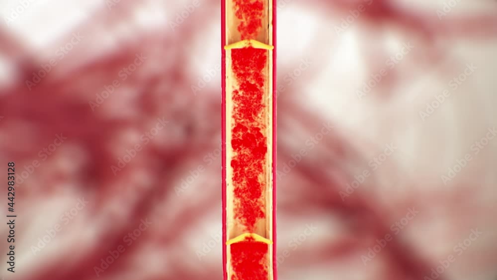 Leg vein anatomy, venous valve function, blood flow, erythrocytes ...
