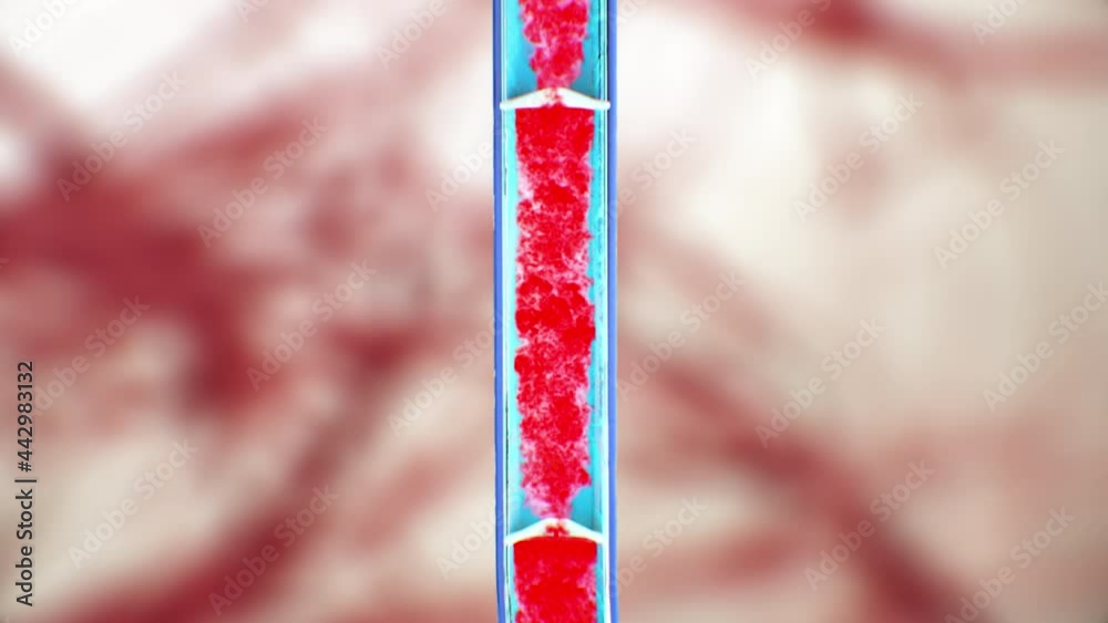 Leg vein anatomy, venous valve function, blood flow, erythrocytes ...