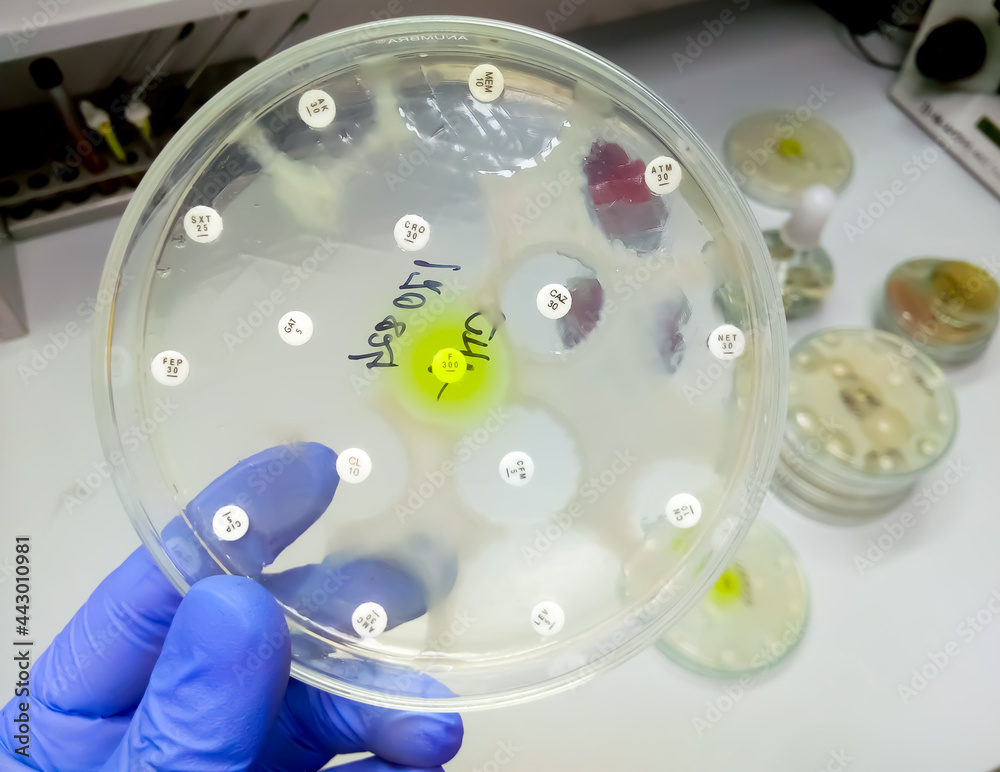 Antimicrobial susceptibility testing in petri dish. Antibiotic ...