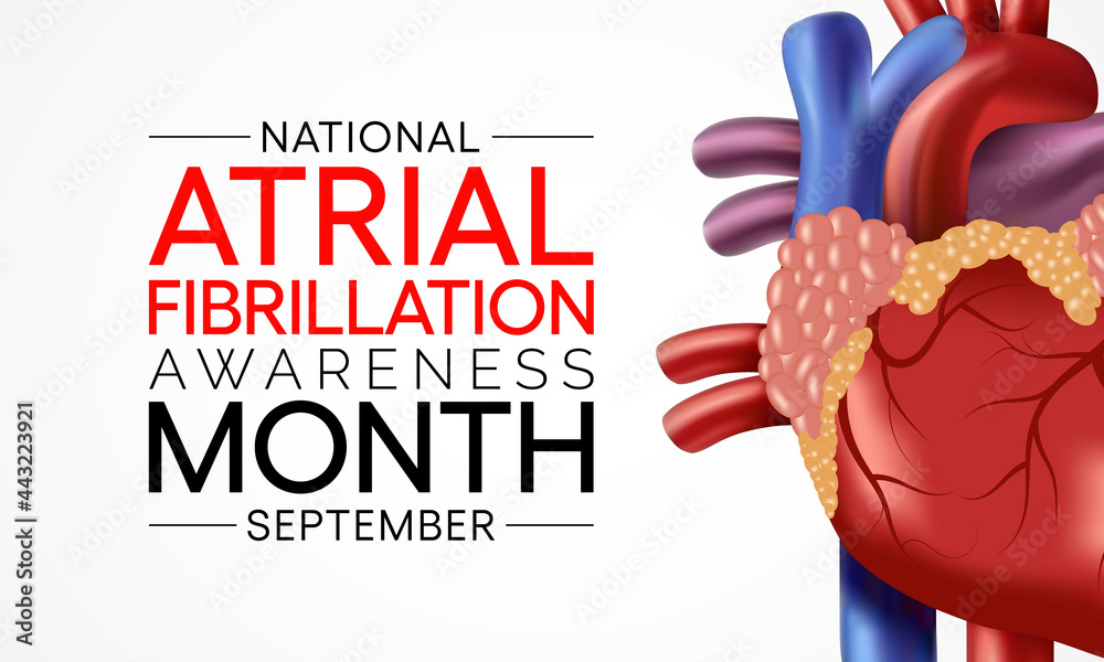 Fast Atrial Fibrillation