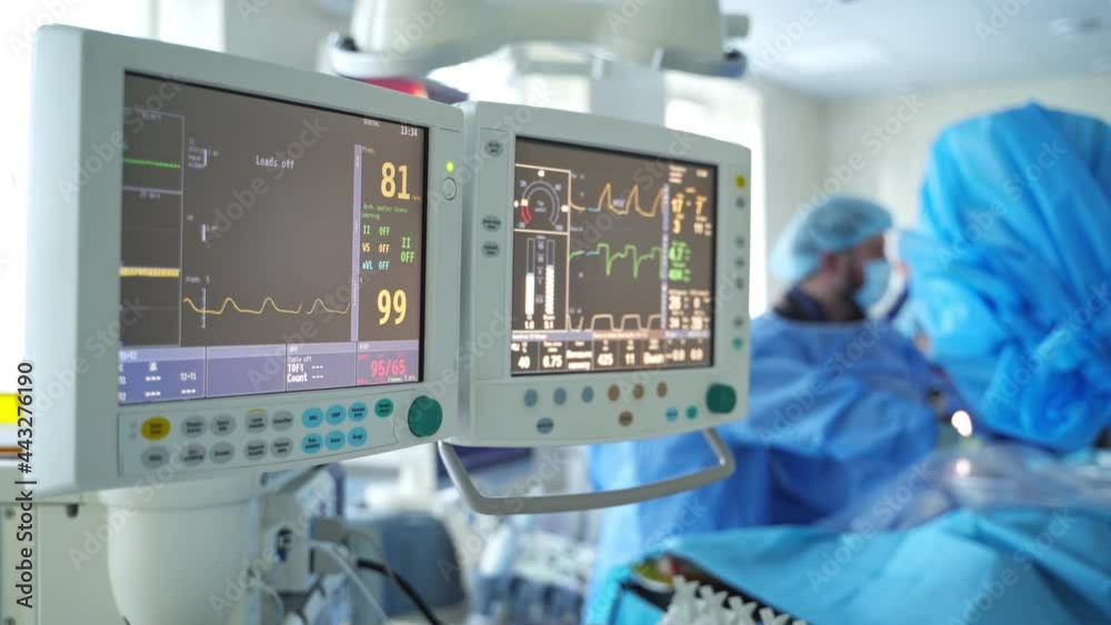 Real medical monitor displays vital signs during surgery. Graphics of ...