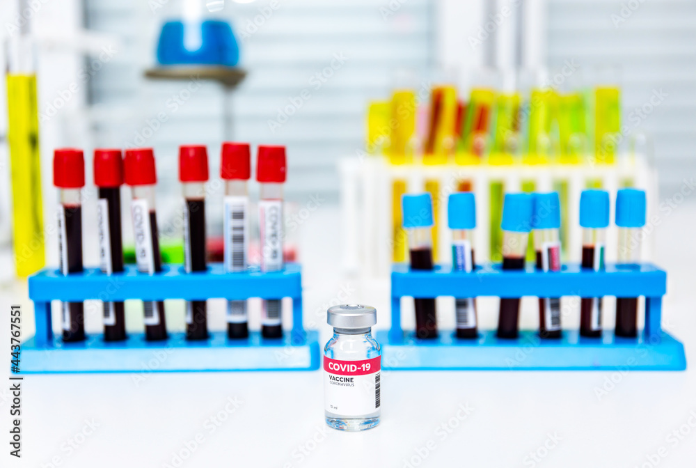 lab tubes and laboratory samples of coronavirus diagnostic blood test ...