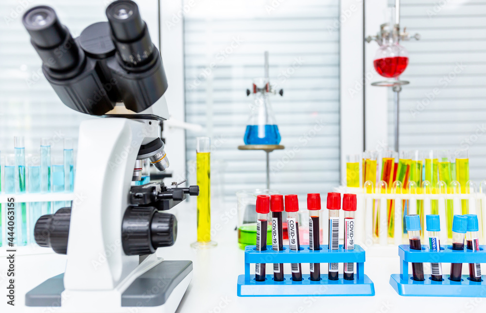 Room test tubes and lab samples of coronavirus diagnostic blood test ...