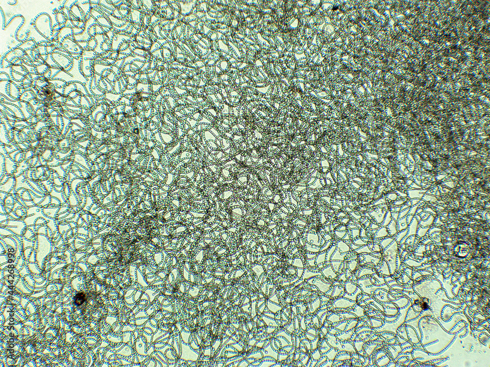 Nostoc sp. algae under microscopic view, cyanobacteria, providing ...