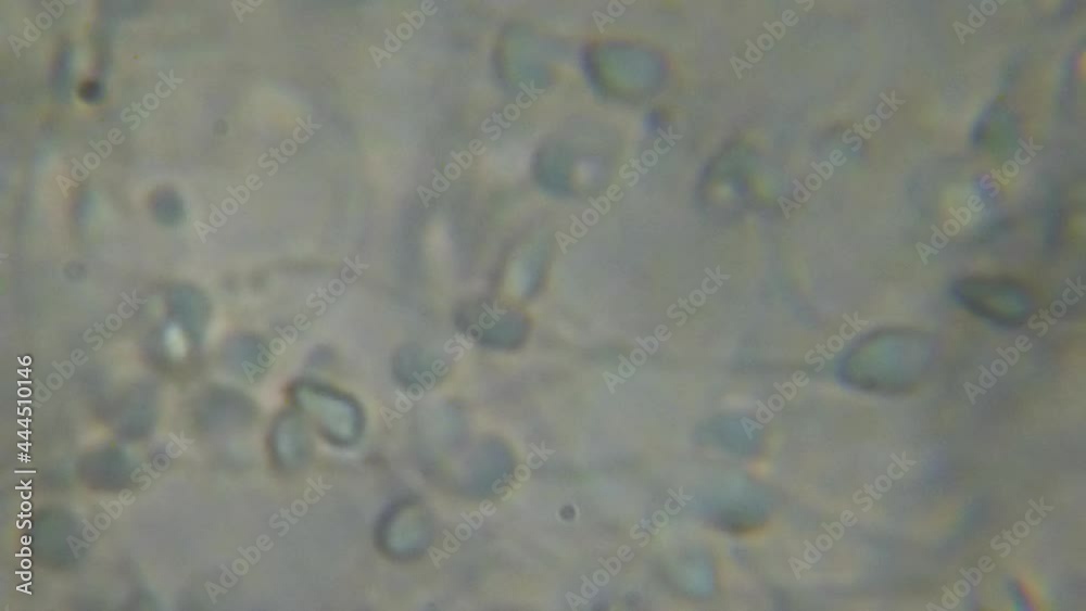 Moving Human Sperm Under Phase Contrast Microscope Sperm Spermatozoa
