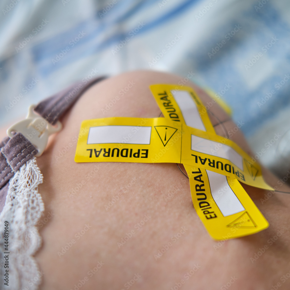 Hand with dropper needle and epidural anesthesia injection. Pregnant ...