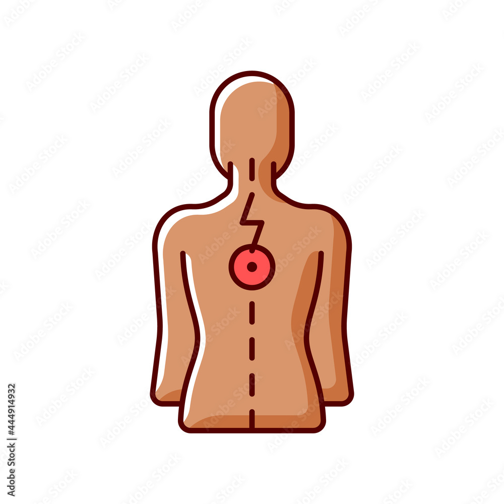 Pressure on spinal nerves RGB color icon. Muscle spasms. Pain between ...