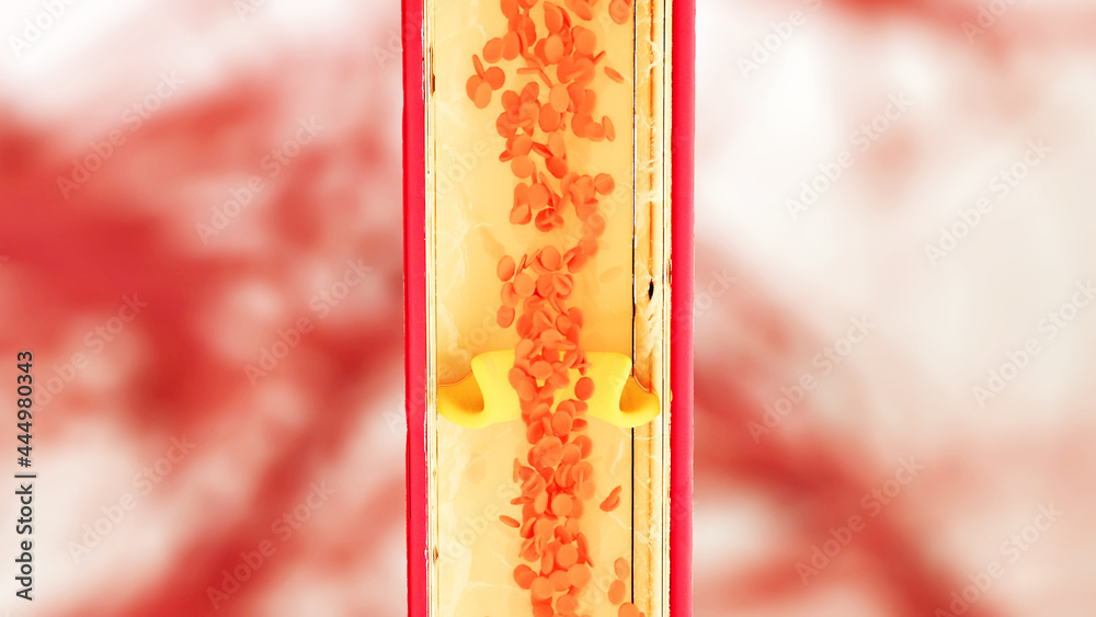 Leg vein anatomy, venous valve function, blood flow, erythrocytes ...